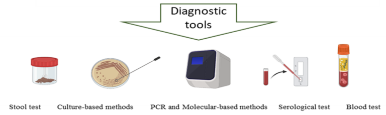 Diagnostic Tools For Detecting GI Infections - IFFGD